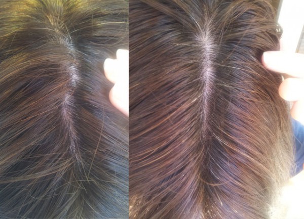 crecimiento-de-pelo-raiz - Treinta y...